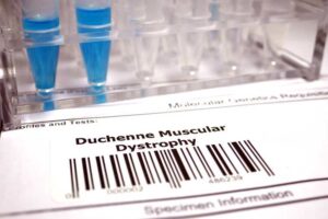 Dyne stock tumbles 31% amid drug updates, management changes (NASDAQ ...